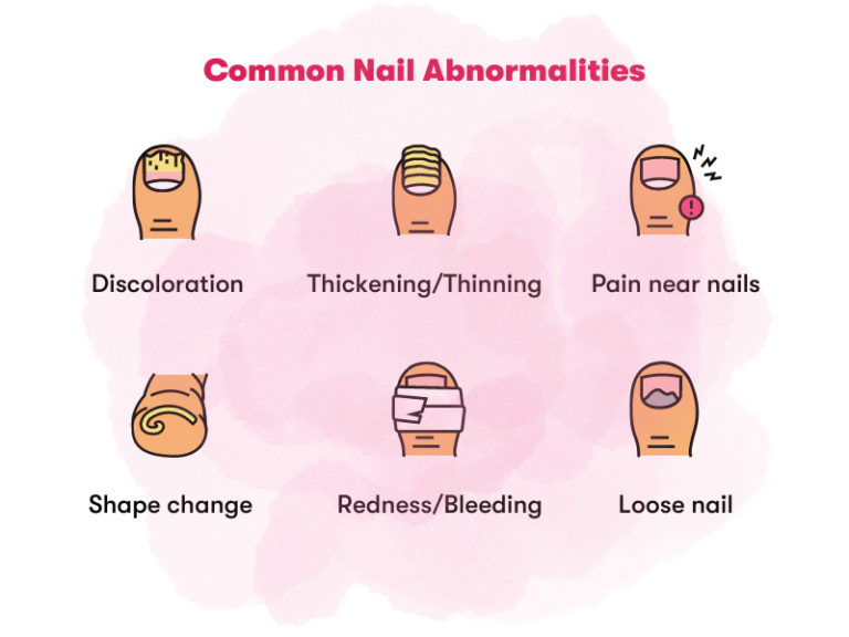 When Should You See a Dermatologist about Nail concerns?