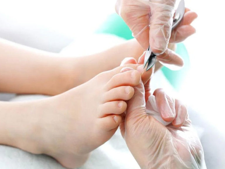 When Should You See a Dermatologist about Nail concerns?