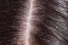 Understanding Weeping Eczema - RemoteDerm