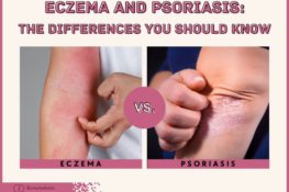 Nail Diseases Chart: Picture, Sign and Treatment - RemoteDerm