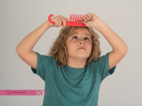 Ultimate Guide to Child Hair Loss - RemoteDerm