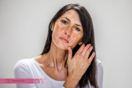 What causes filiform warts - RemoteDerm