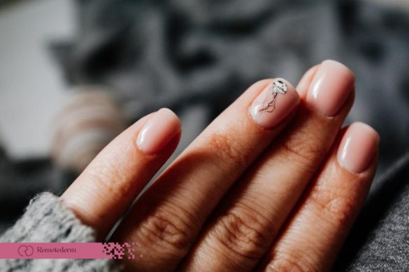 Nail Diseases Chart: Picture, Sign and Treatment