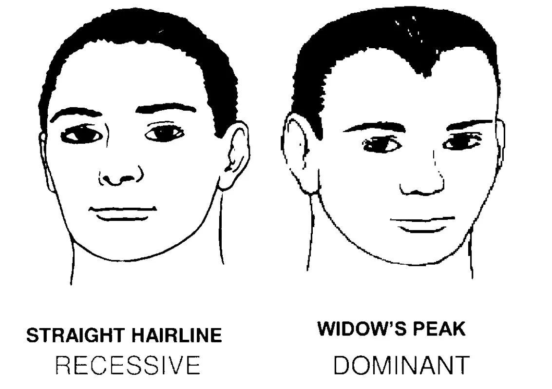 Understanding Every Type of Hairline - RemoteDerm