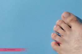 Understanding the Nail Matrix - RemoteDerm