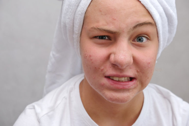 Understanding Skin Lumps - RemoteDerm