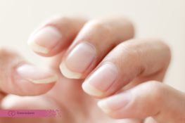 Facial Plethora: Causes and Treatments - RemoteDerm