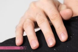 What Causes Terry's Nails? - RemoteDerm