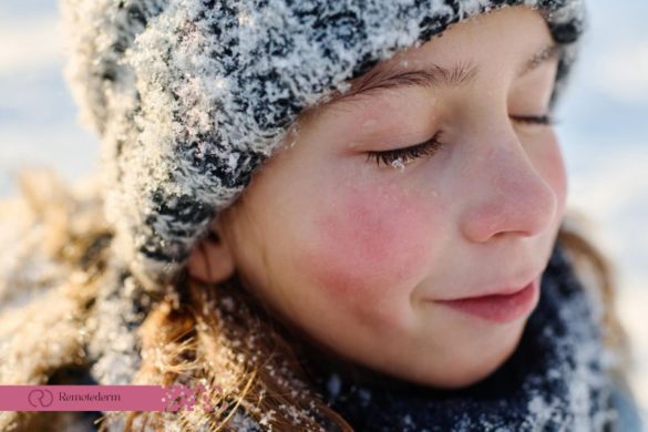 Ringworm rashes | causes and treatments - Remotederm